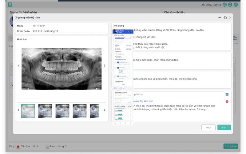 Hệ thống RIS là gì? Phân biệt RIS, PACS và HIS và sự liên kết